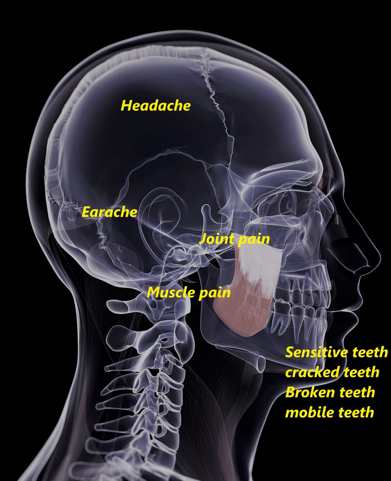 TMJ Pain and Disorders | Alexandra Dental Clinic